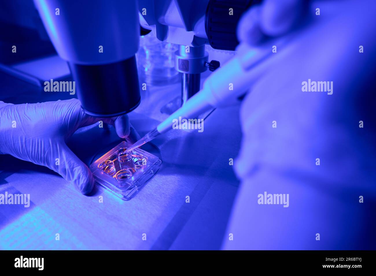 Embriologist putting sperm sample to examine under microscope Stock ...