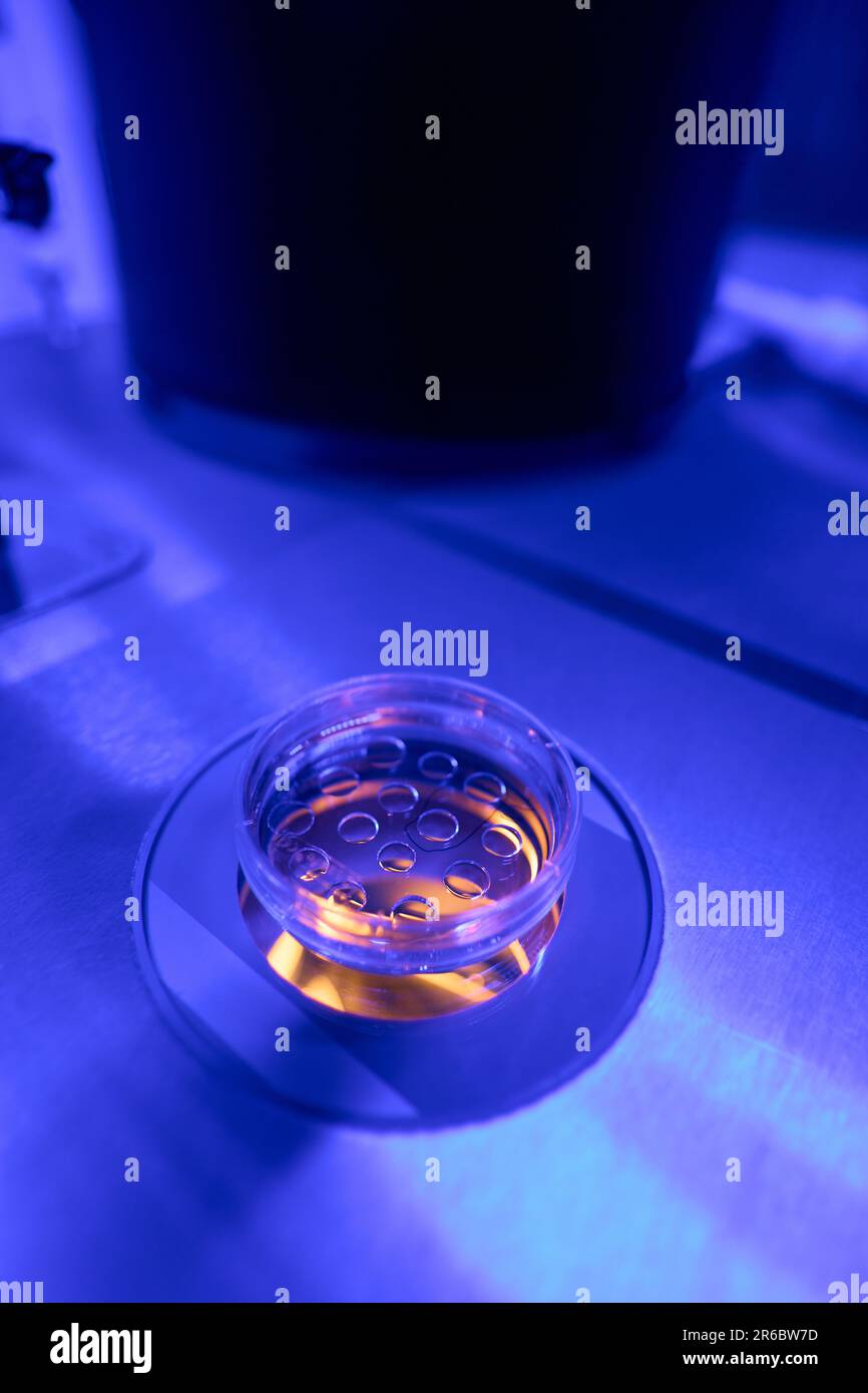 Stem cells on petri dish under microscope objective lens Stock Photo ...