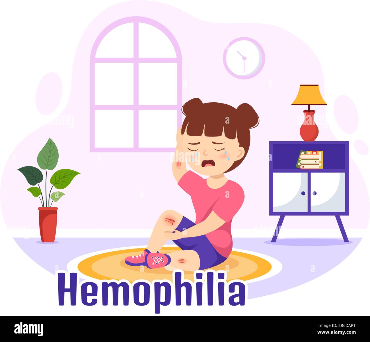 Hemophilia Vector Illustration with Doctor Examining Injured Knee or ...