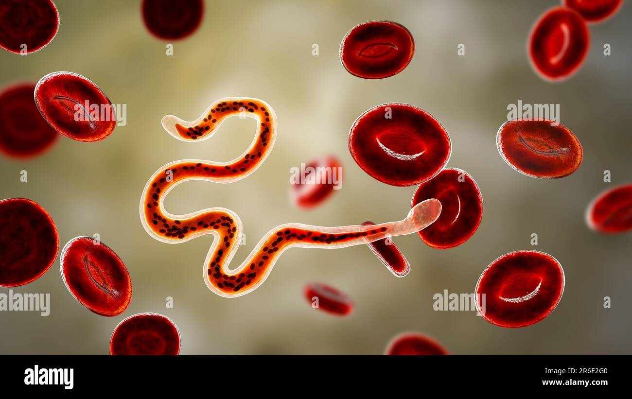 Computer illustration of Brugia malayi a parasitic nematode worm and ...