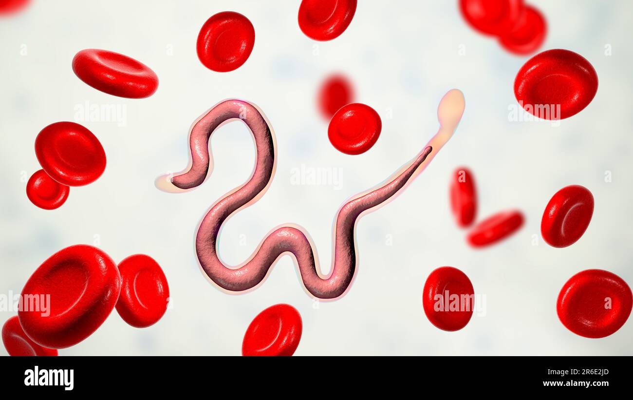 Computer illustration of Brugia malayi a parasitic nematode worm and ...