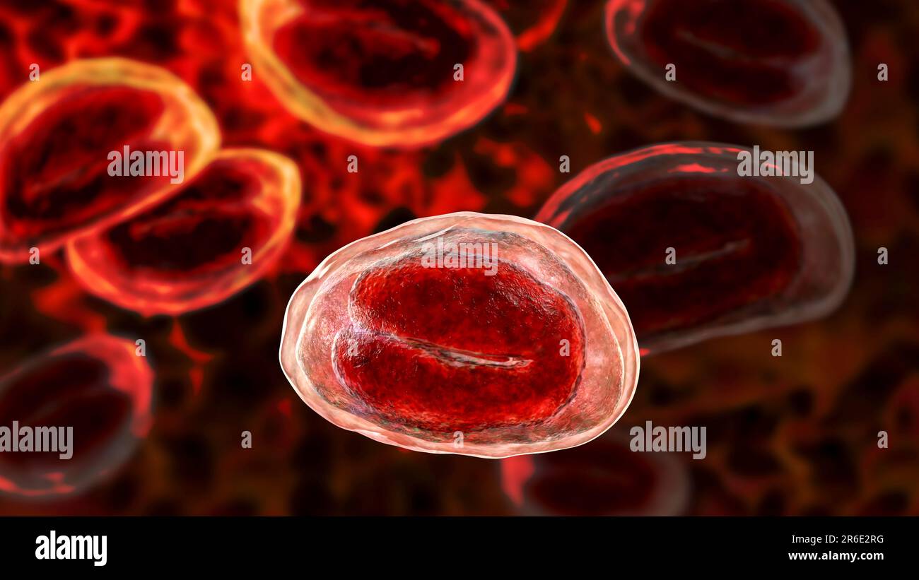 Threadworm (Enterobius vermicularis) eggs containing worm larvae ...