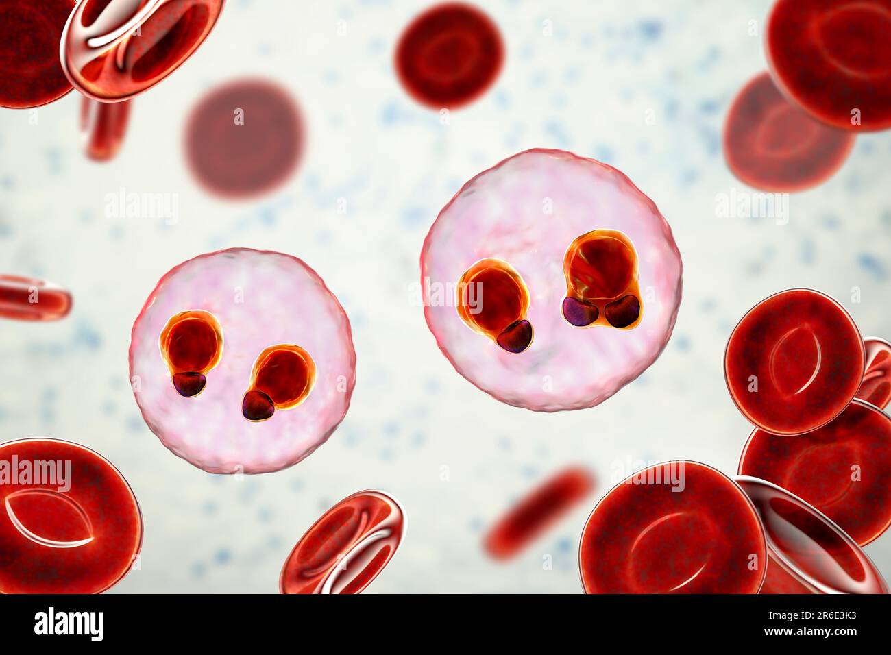 Protozoan Plasmodium falciparum inside red blood cell, computer artwork ...