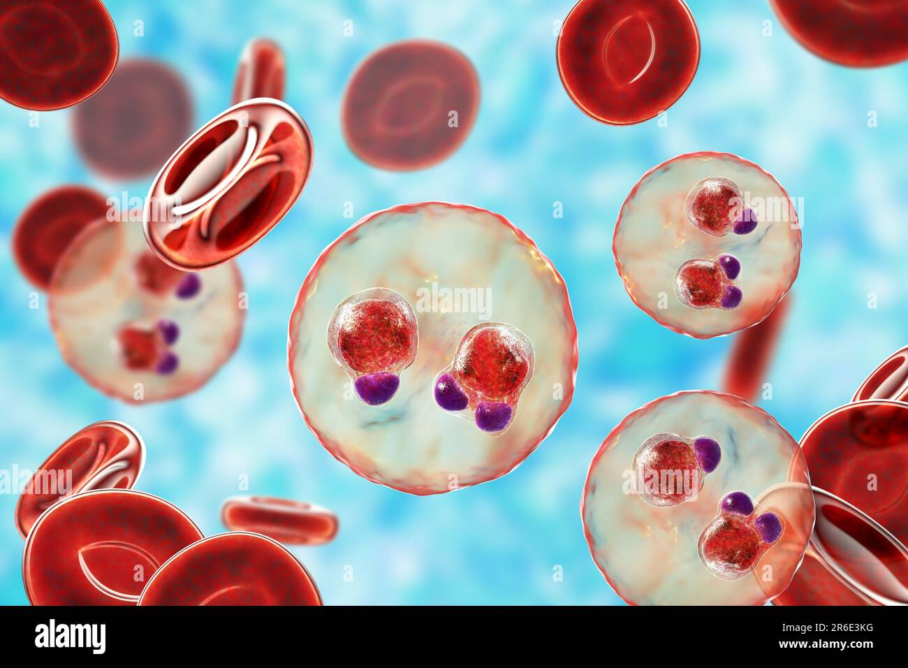 Protozoan Plasmodium falciparum inside red blood cell, computer artwork ...