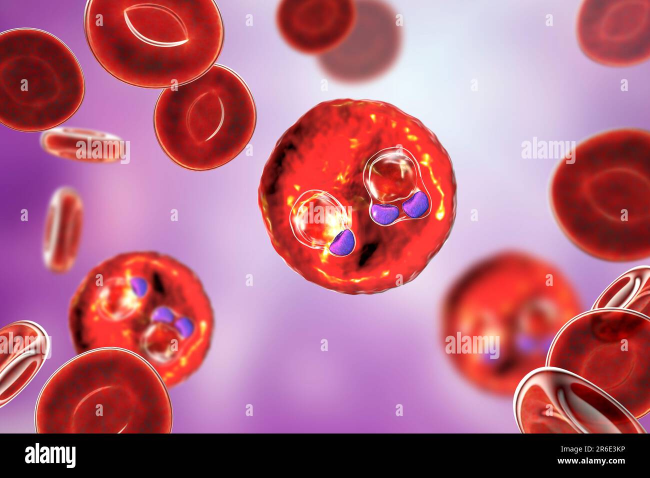 Protozoan Plasmodium falciparum inside red blood cell, computer artwork ...