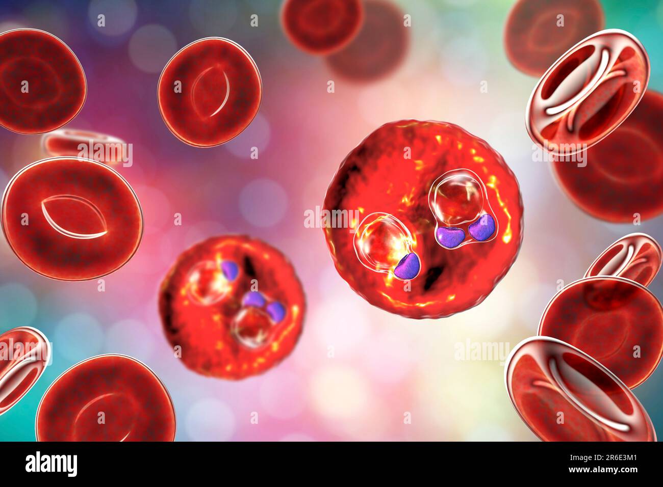 Protozoan Plasmodium falciparum inside red blood cell, computer artwork ...