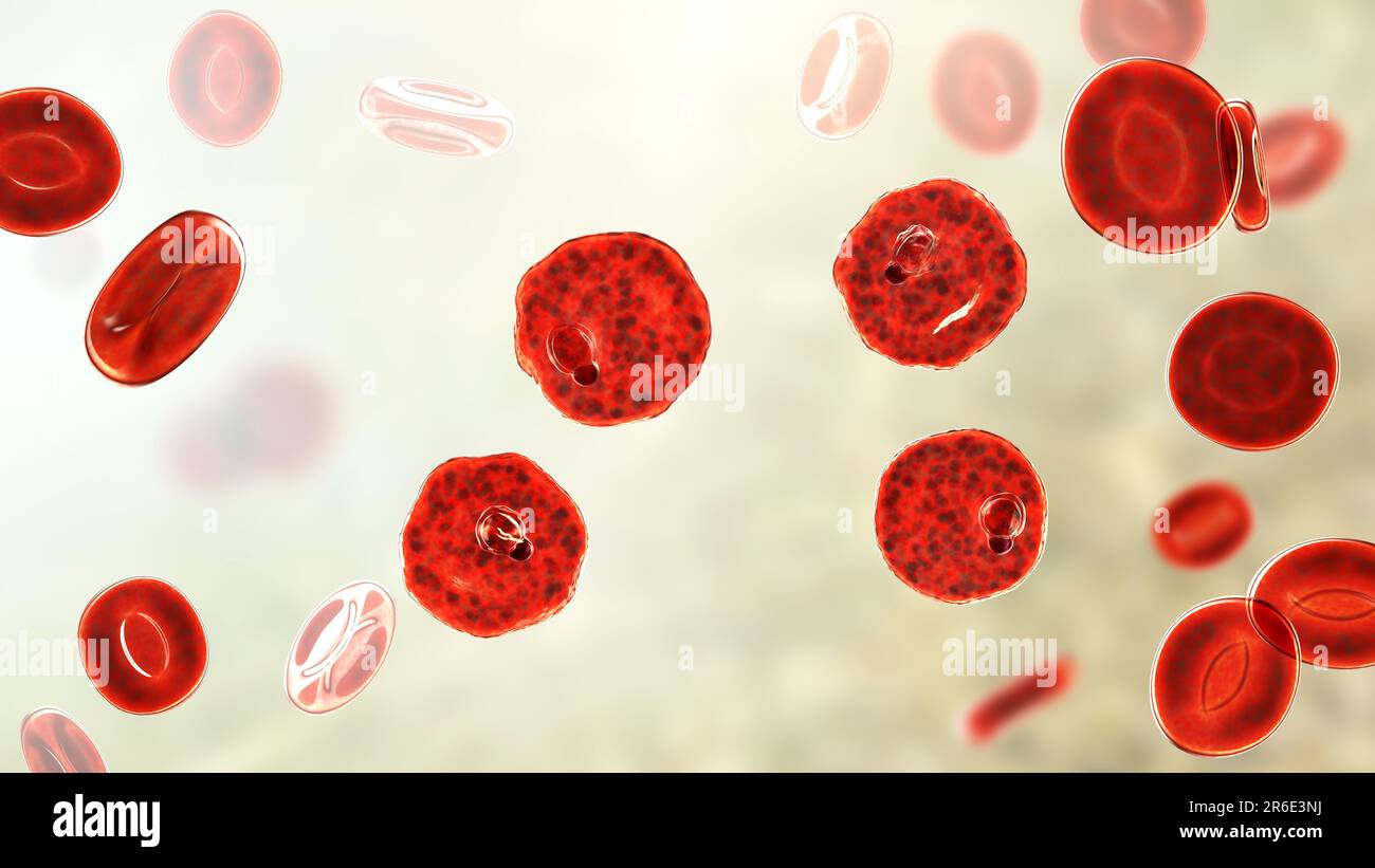 Protozoan Plasmodium vivax inside red blood cells, computer artwork. P ...