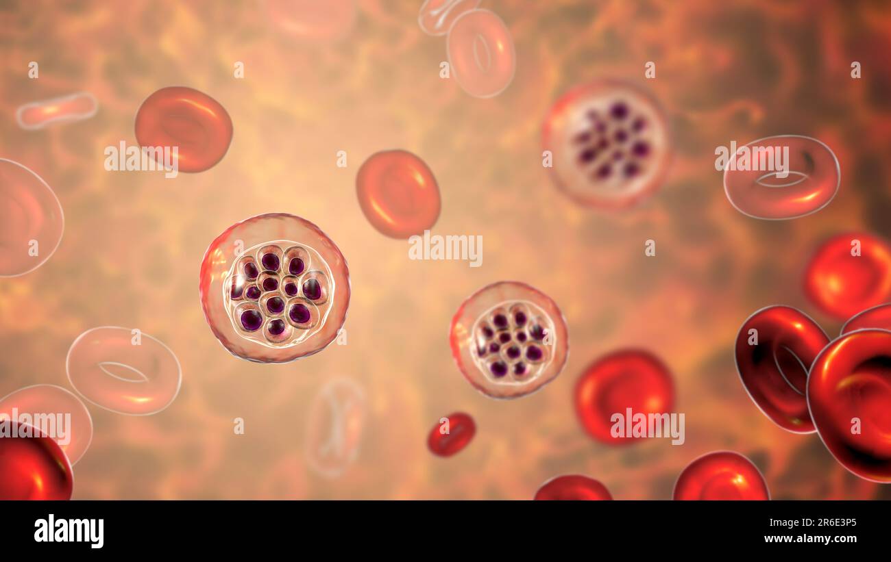 Protozoan Plasmodium vivax inside red blood cells, computer artwork. P ...