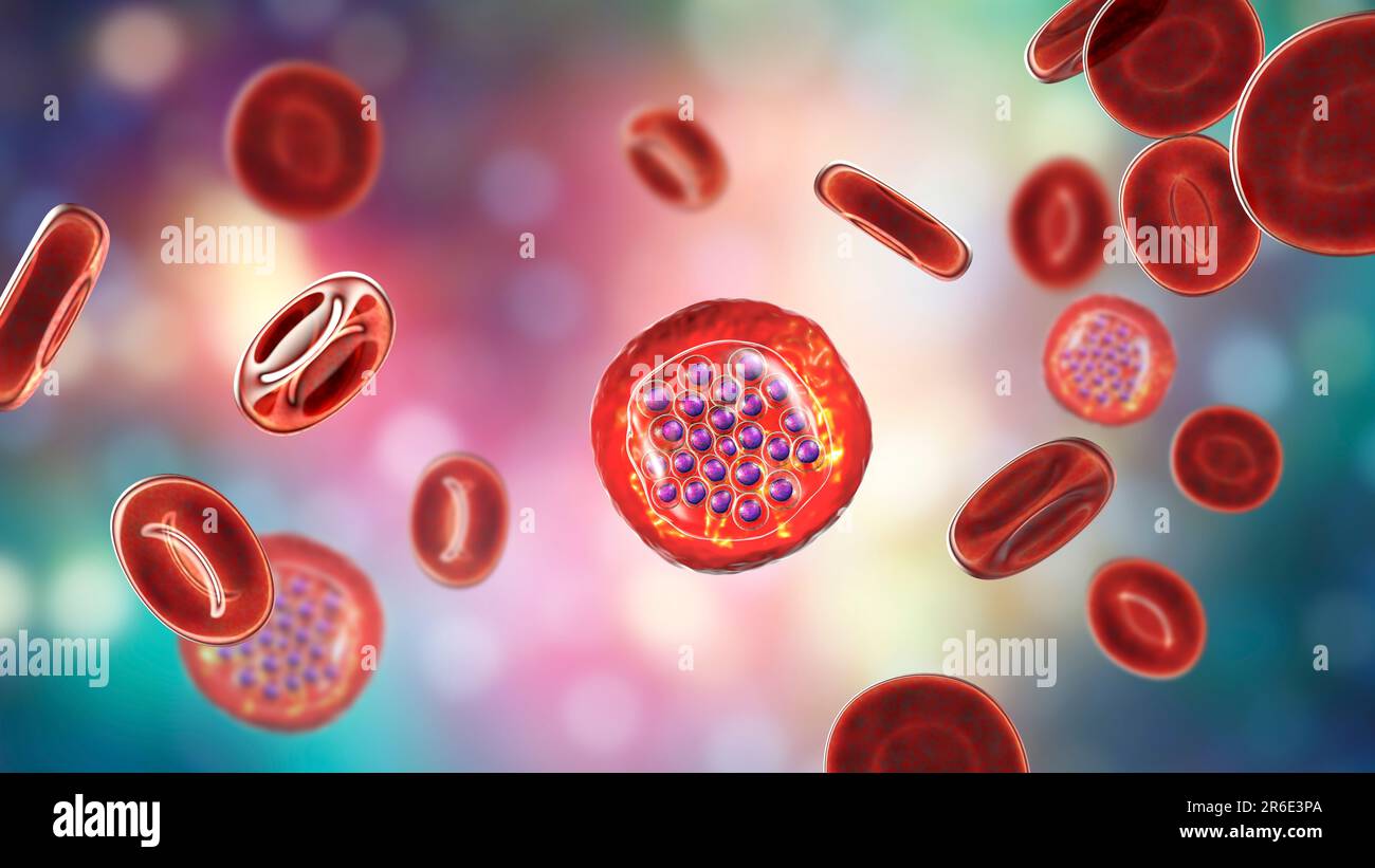 Protozoan Plasmodium falciparum inside red blood cell, computer artwork ...