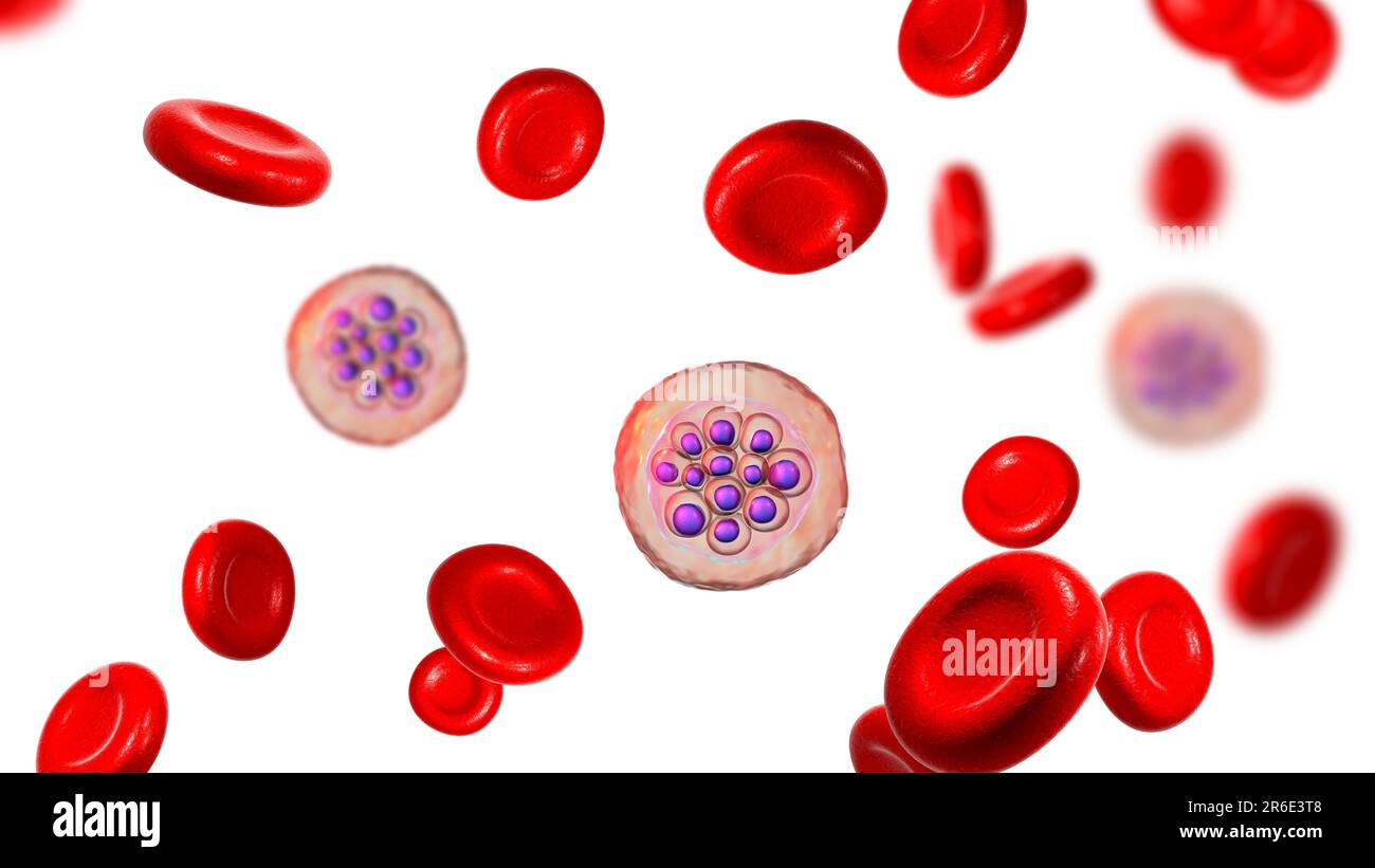 Protozoan Plasmodium vivax inside red blood cells, computer artwork. P ...