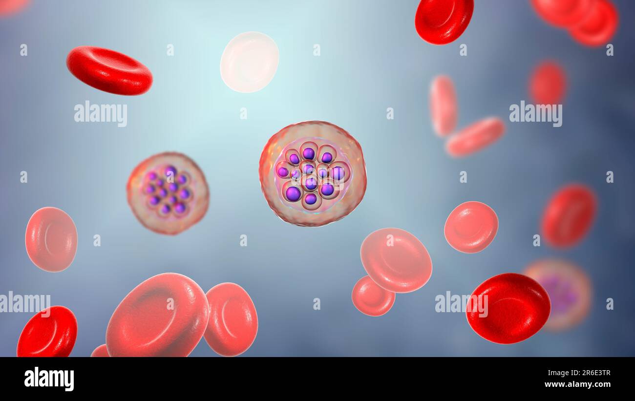Protozoan Plasmodium vivax inside red blood cells, computer artwork. P ...