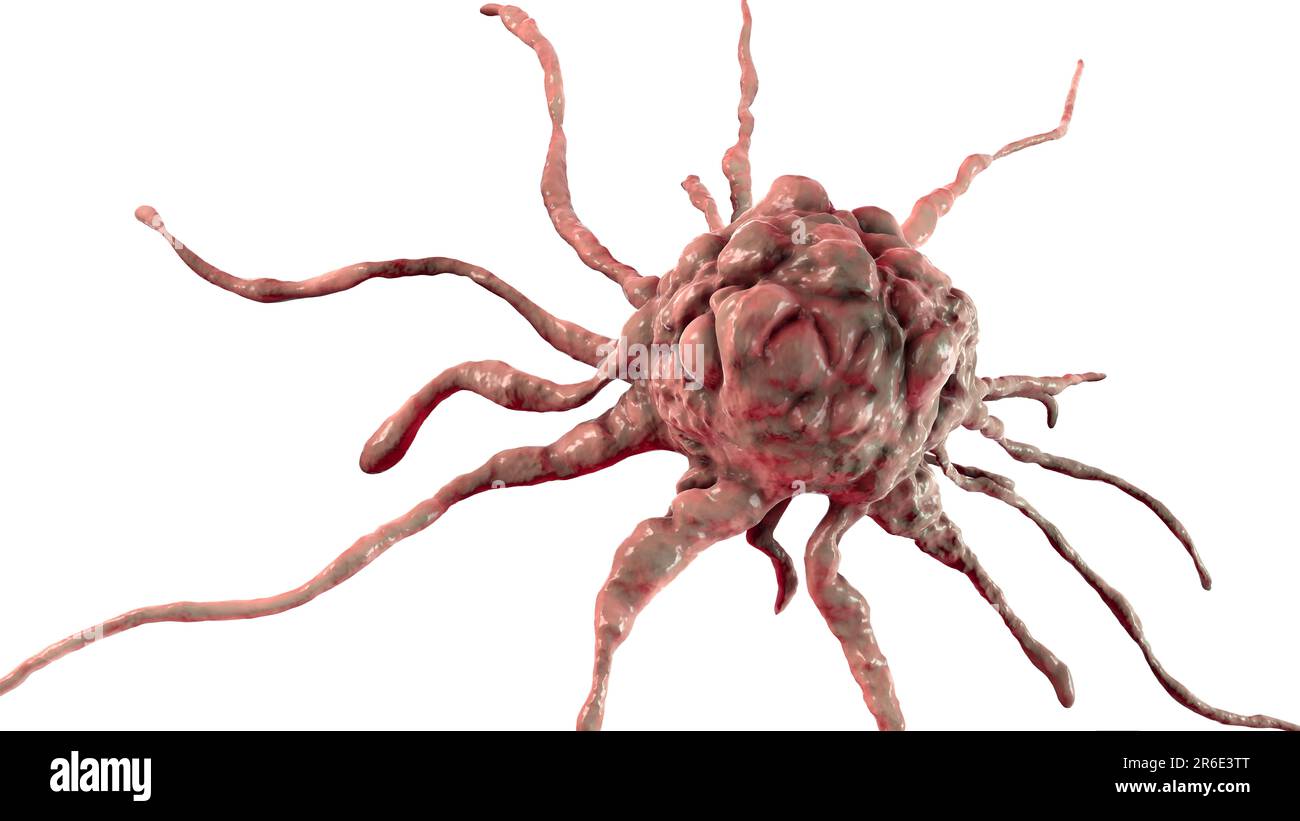 Cancer cell, computer illustration Stock Photo - Alamy