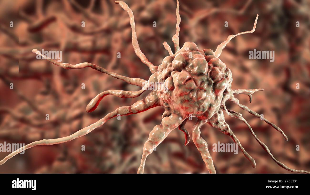 Cancer cell, computer illustration Stock Photo - Alamy