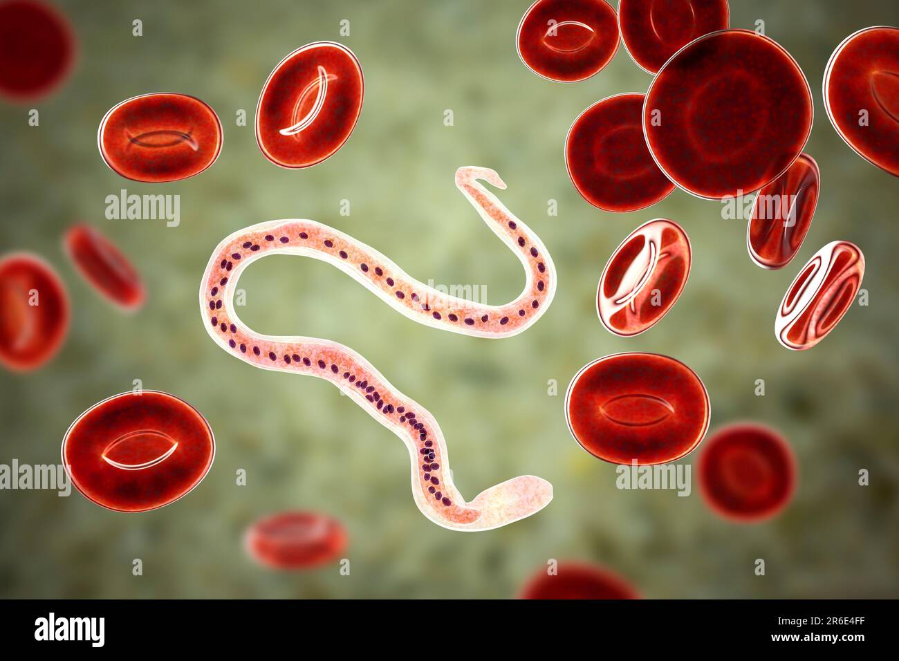 Wuchereria bancrofti. Computer illustration of the microfilaria larval ...