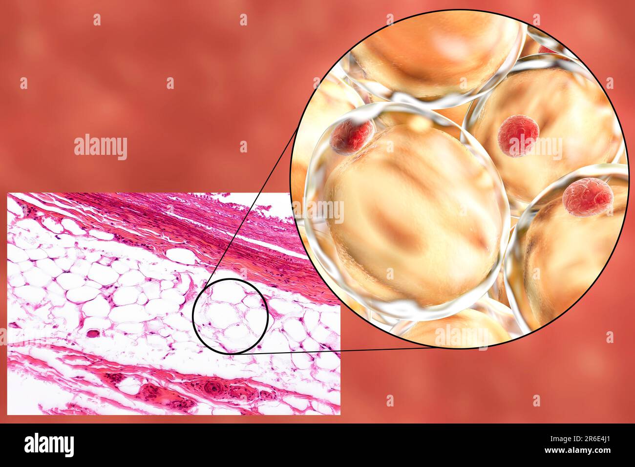 Fat Cells Light Micrograph And Computer Illustration White Adipose Tissue Composed Of