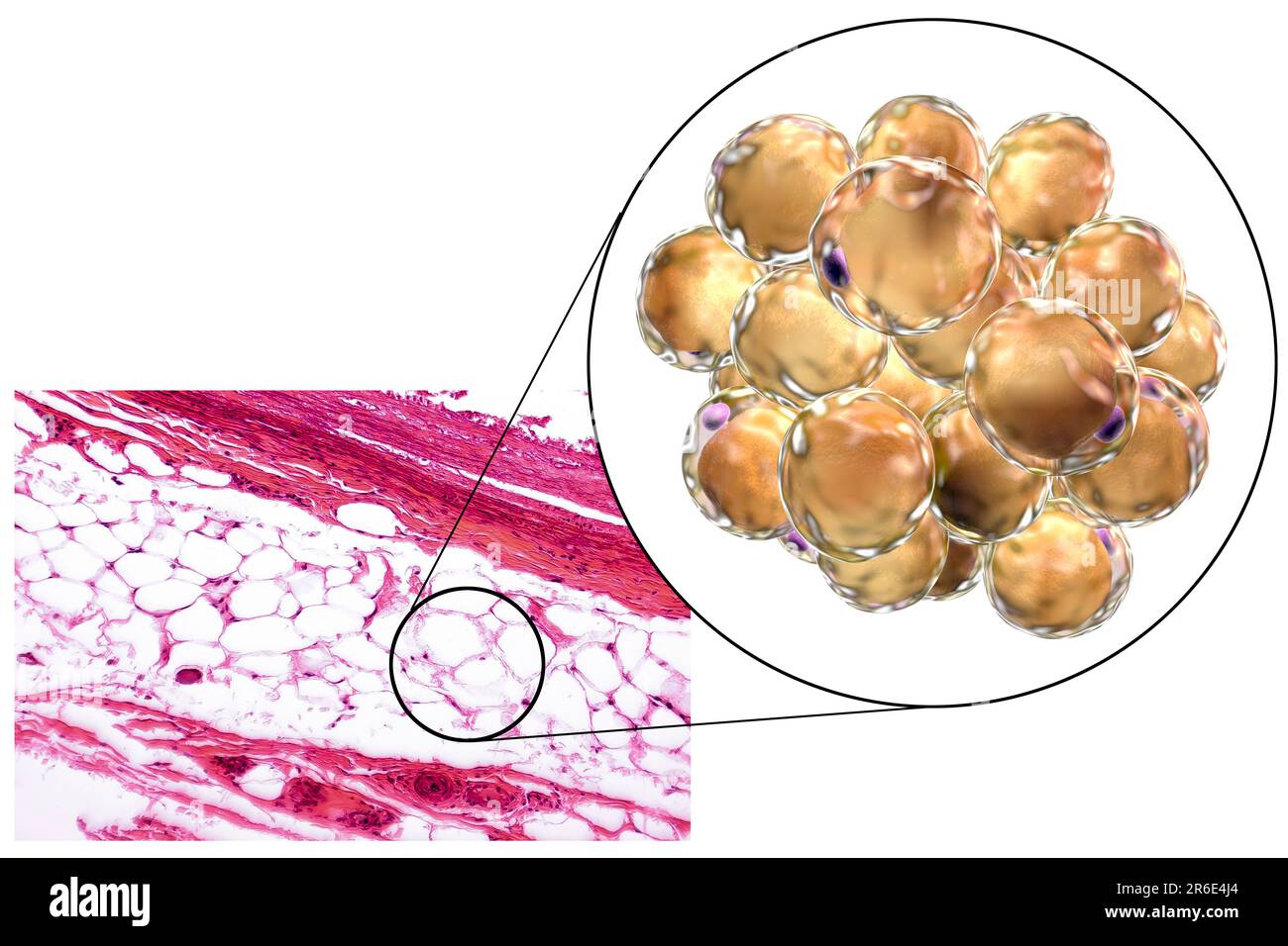 Fat cells, light micrograph and computer illustration. White adipose ...