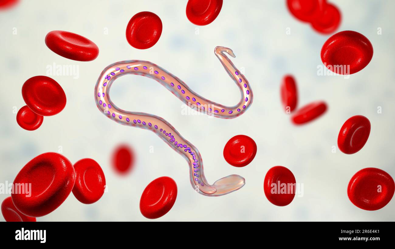 Wuchereria bancrofti. Computer illustration of the microfilaria larval ...