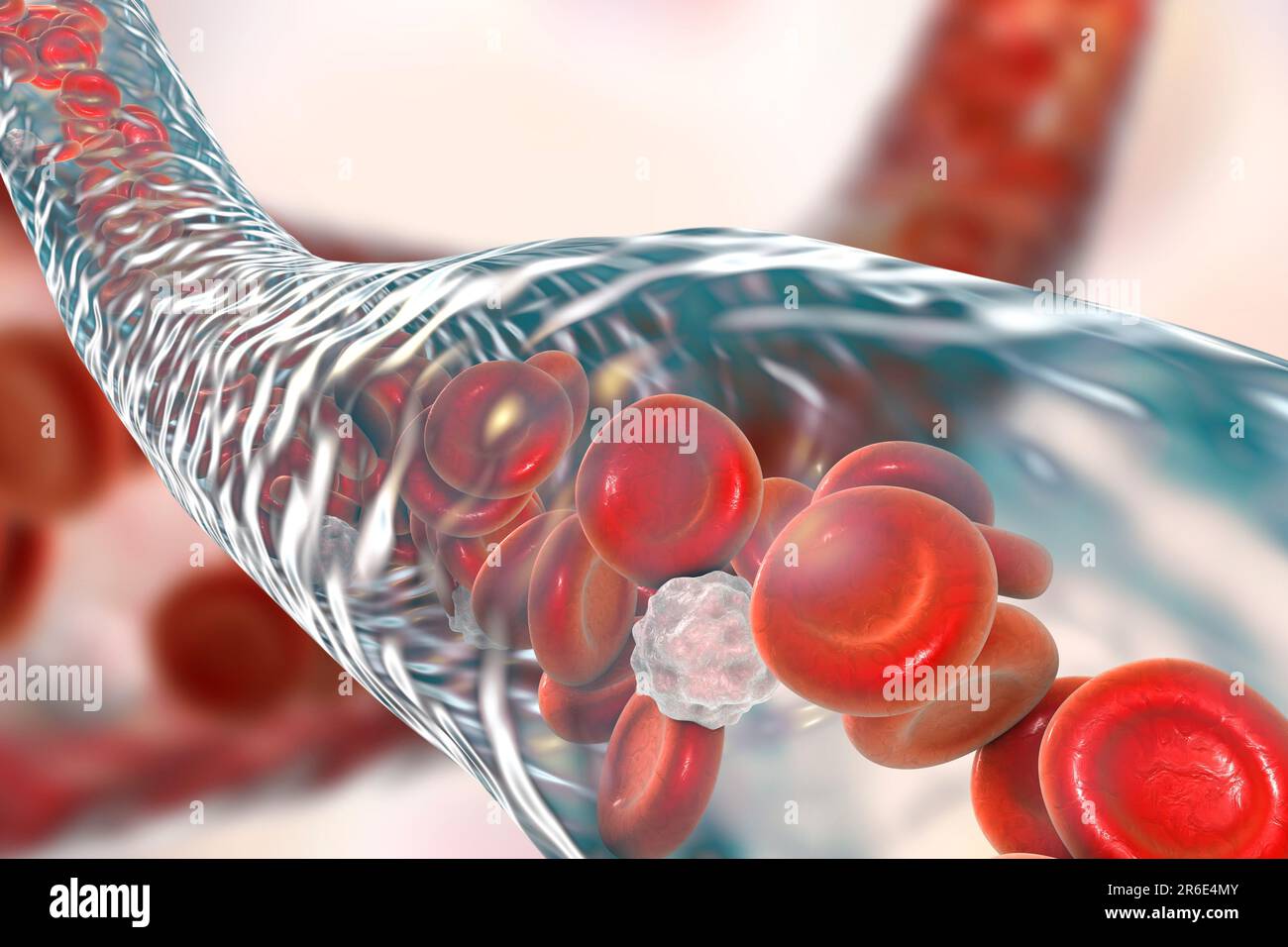 Blood vessel, computer illustration. Red blood cells and white blood ...
