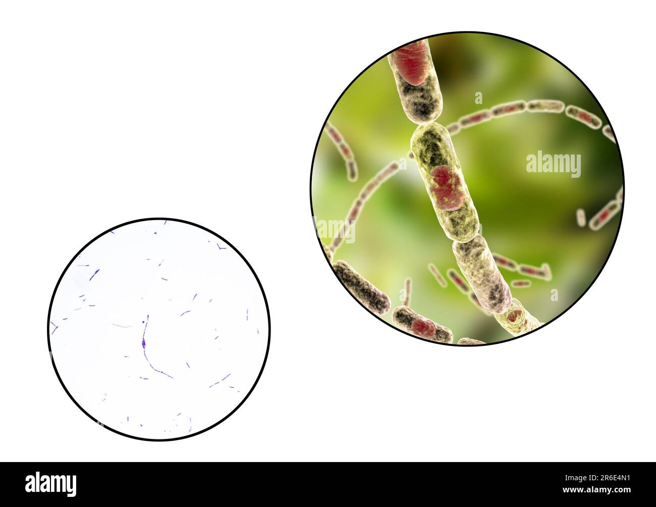 Anthrax bacteria, light micrograph and computer illustration. Anthrax ...