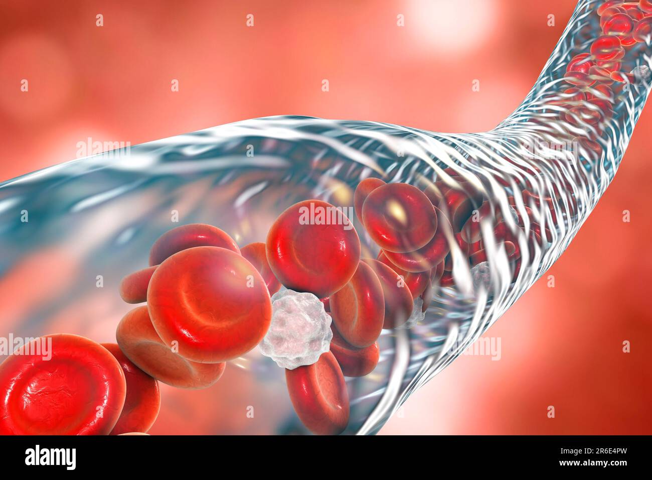 Blood vessel, computer illustration. Red blood cells and white blood ...