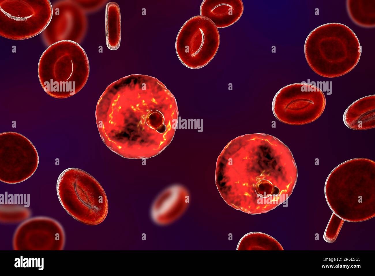 Protozoan Plasmodium malariae inside red blood cell, computer artwork ...