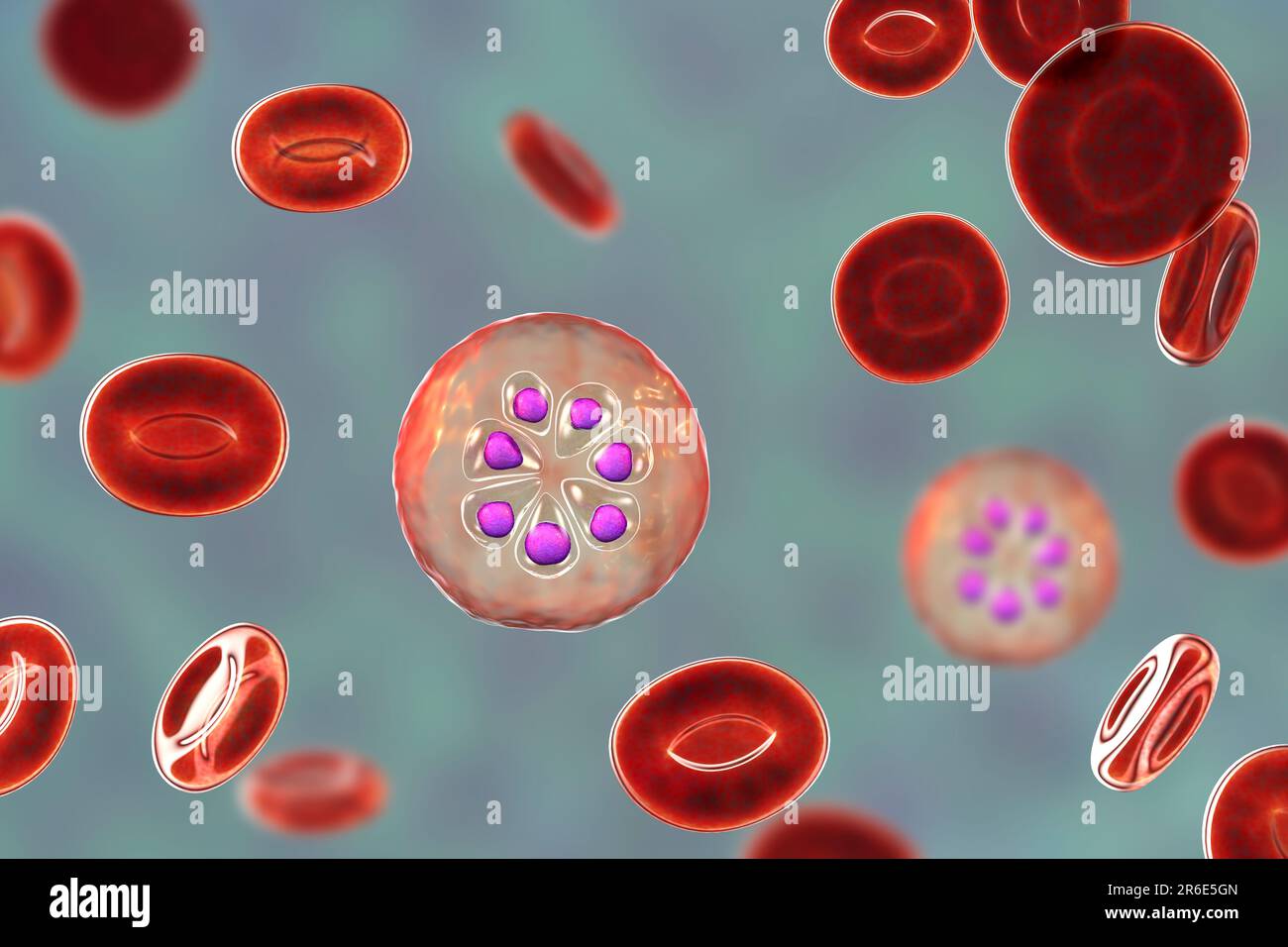 Protozoan Plasmodium malariae inside red blood cells, computer artwork ...