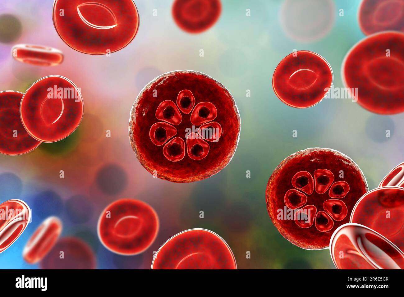Protozoan Plasmodium malariae inside red blood cells, computer artwork ...
