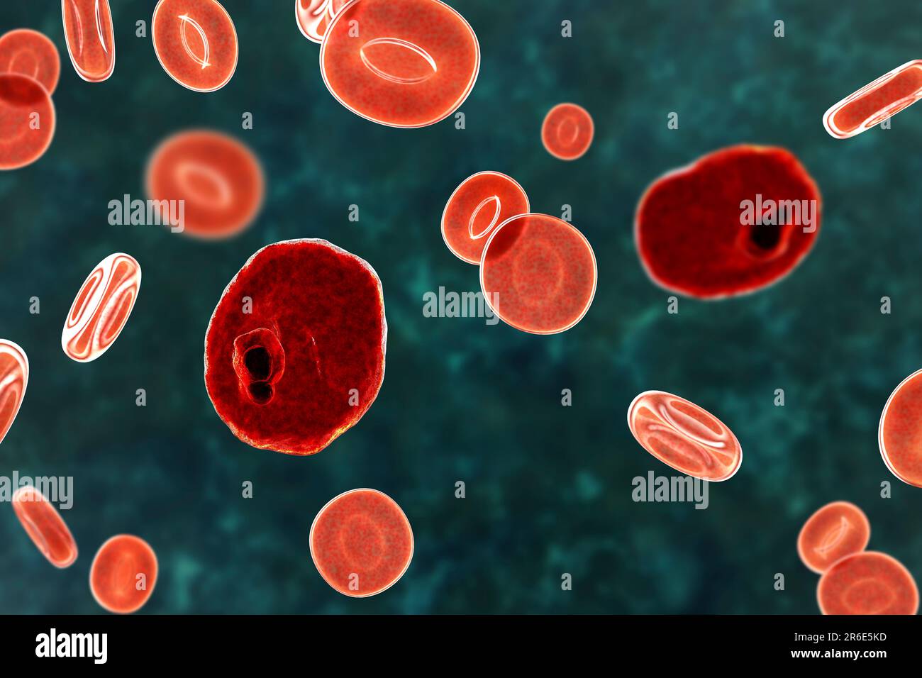 Protozoan Plasmodium ovale inside red blood cell, computer artwork. P ...