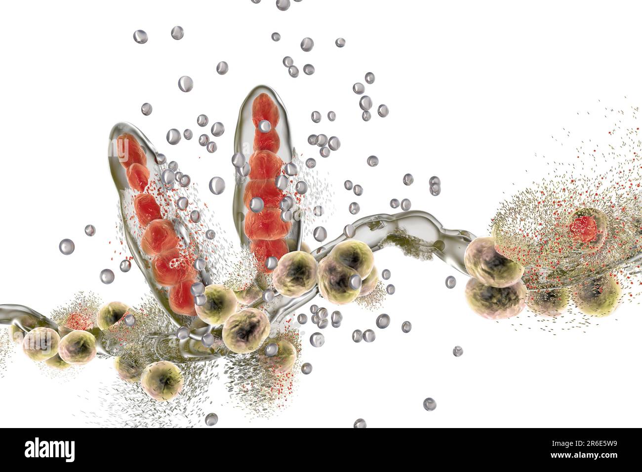 Destruction of Athlete's foot fungus Trichophyton mentagrophytes by ...