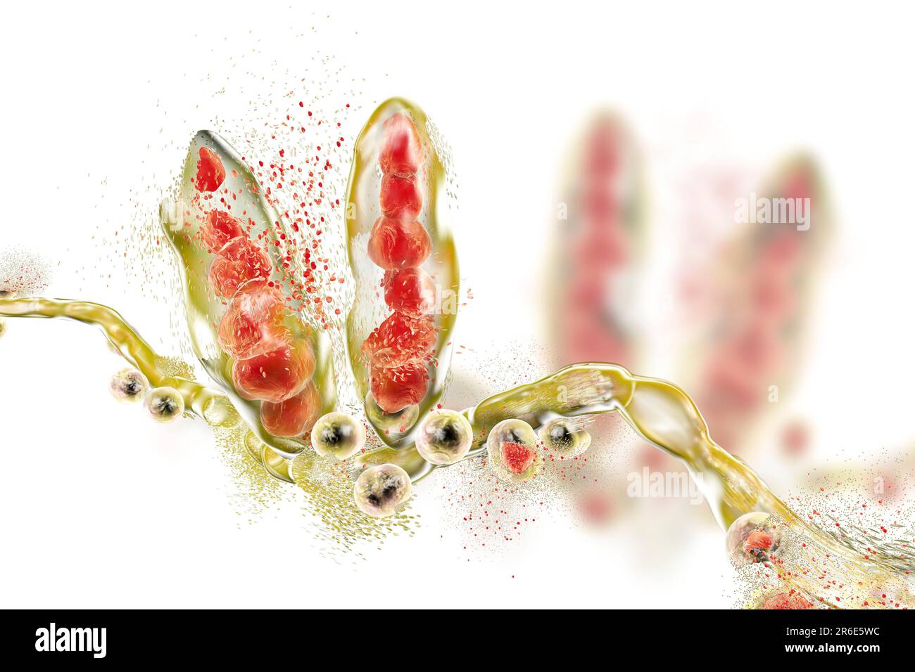 Destruction of Athlete's foot fungus Trichophyton mentagrophytes ...