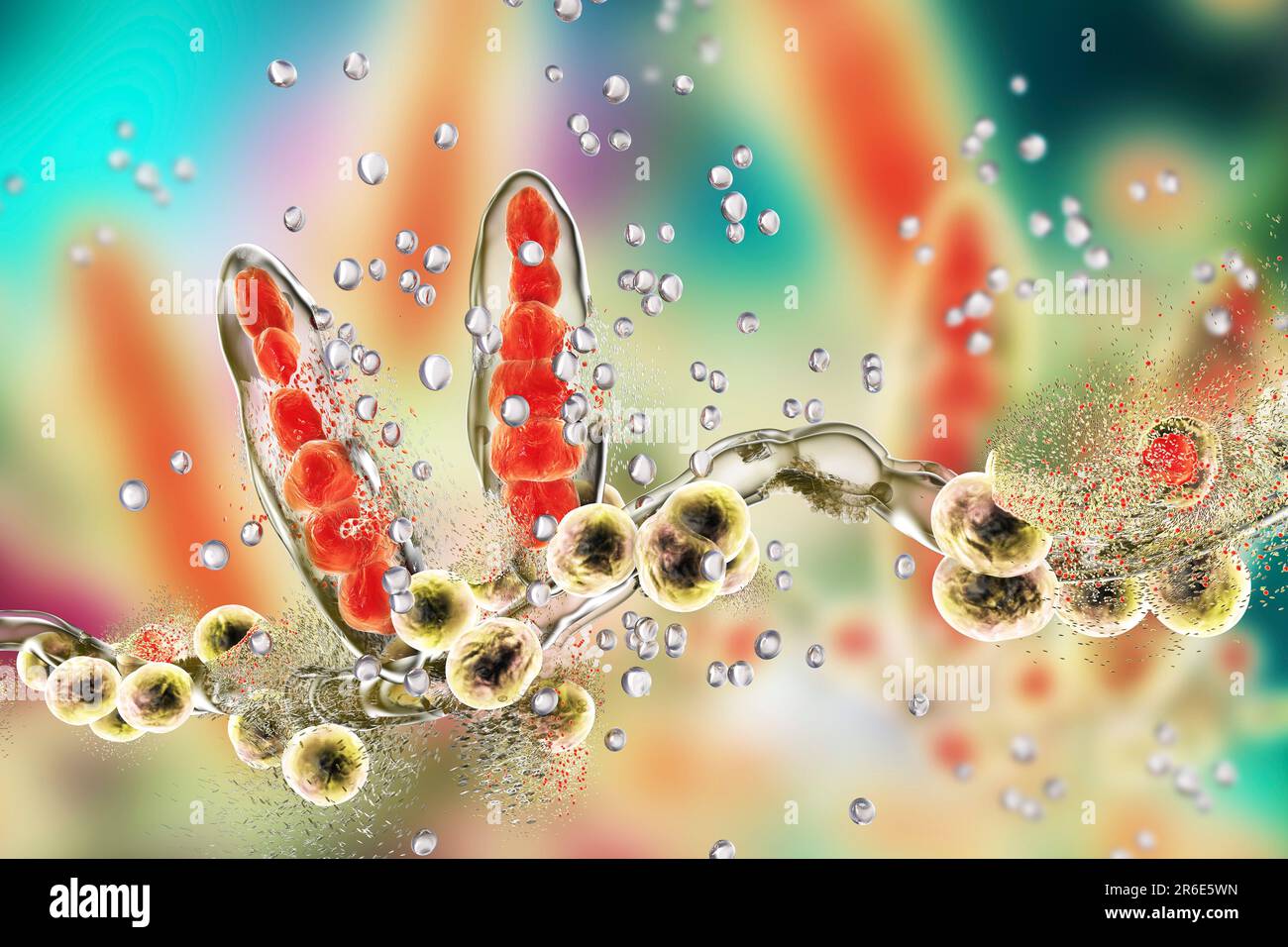 Destruction of Athlete's foot fungus Trichophyton mentagrophytes by ...