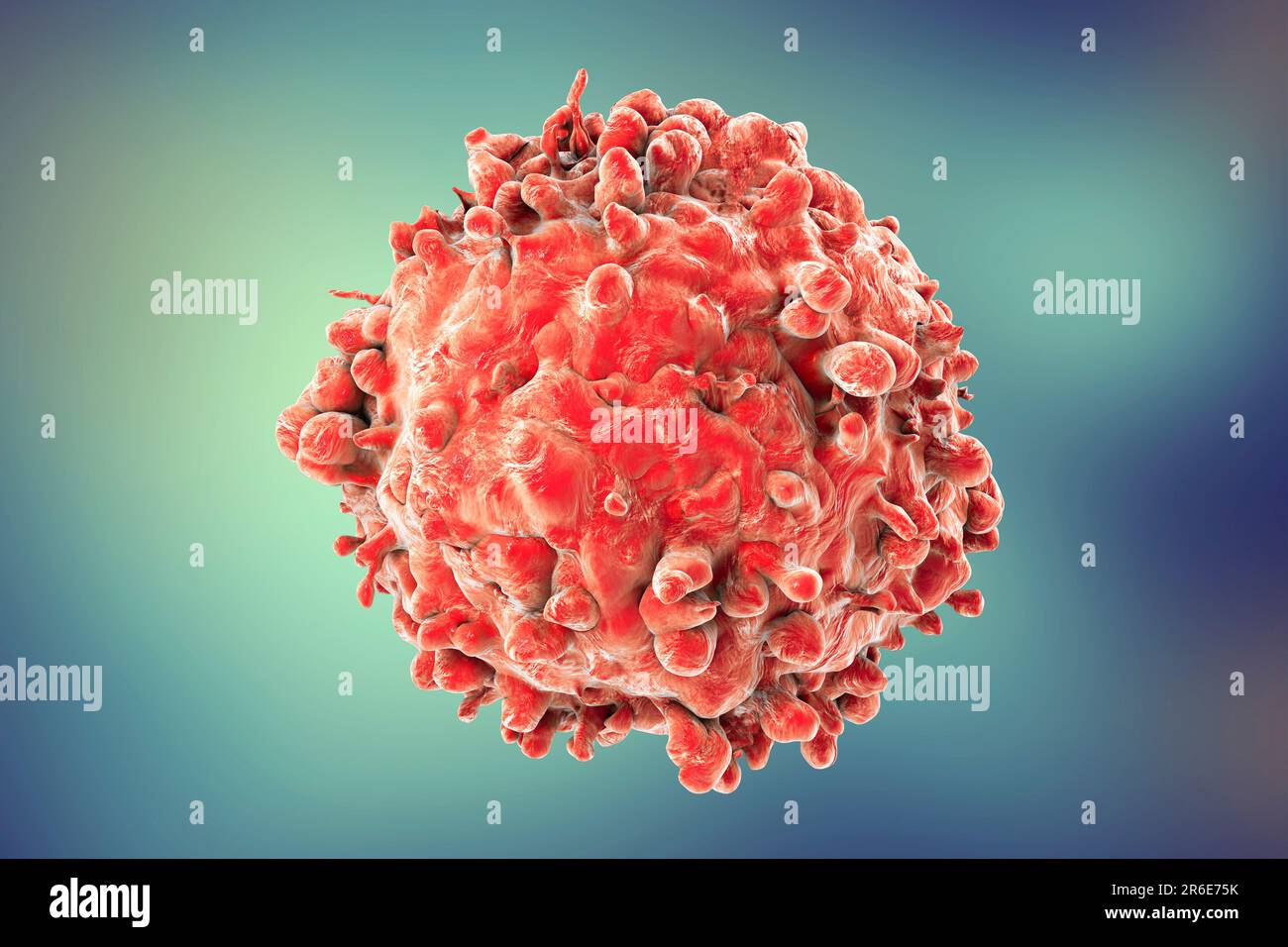 Computer illustration of a cancerous white blood cell in leukaemia ...