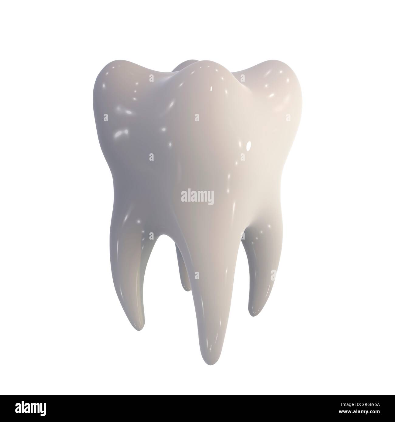 Tooth decay. Computer artwork of a tooth with cavity Stock Photo - Alamy