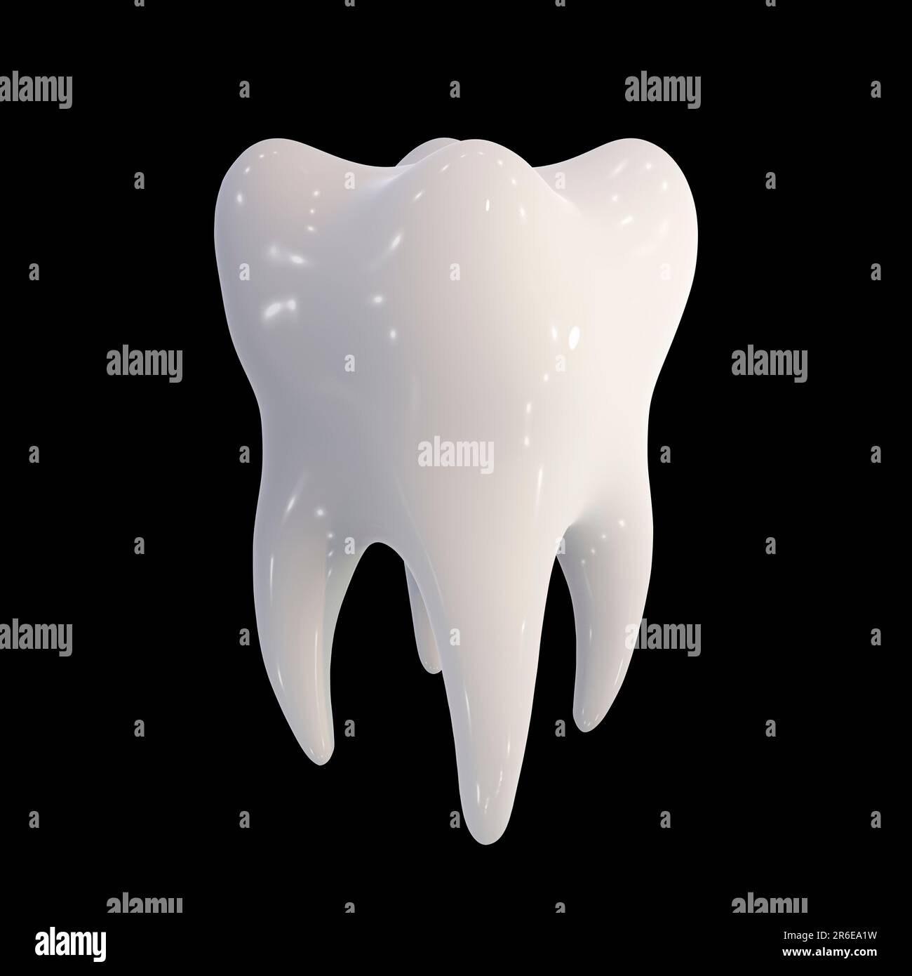 Tooth decay. Computer artwork of a tooth with cavity Stock Photo - Alamy
