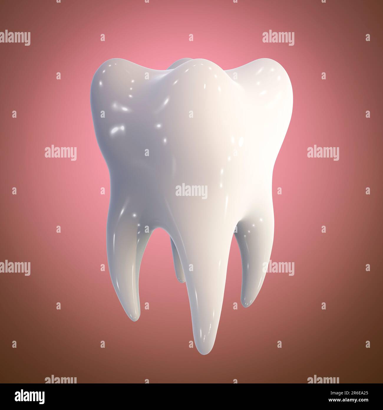 Tooth decay. Computer artwork of a tooth with cavity Stock Photo - Alamy