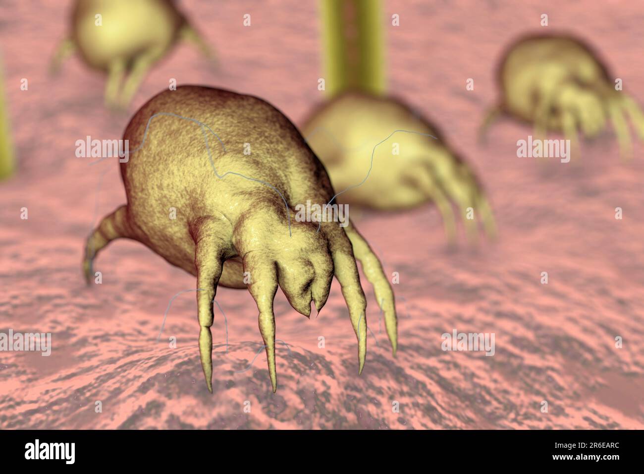 Dust mites dermatophagoides pteronyssinus hi-res stock photography and ...