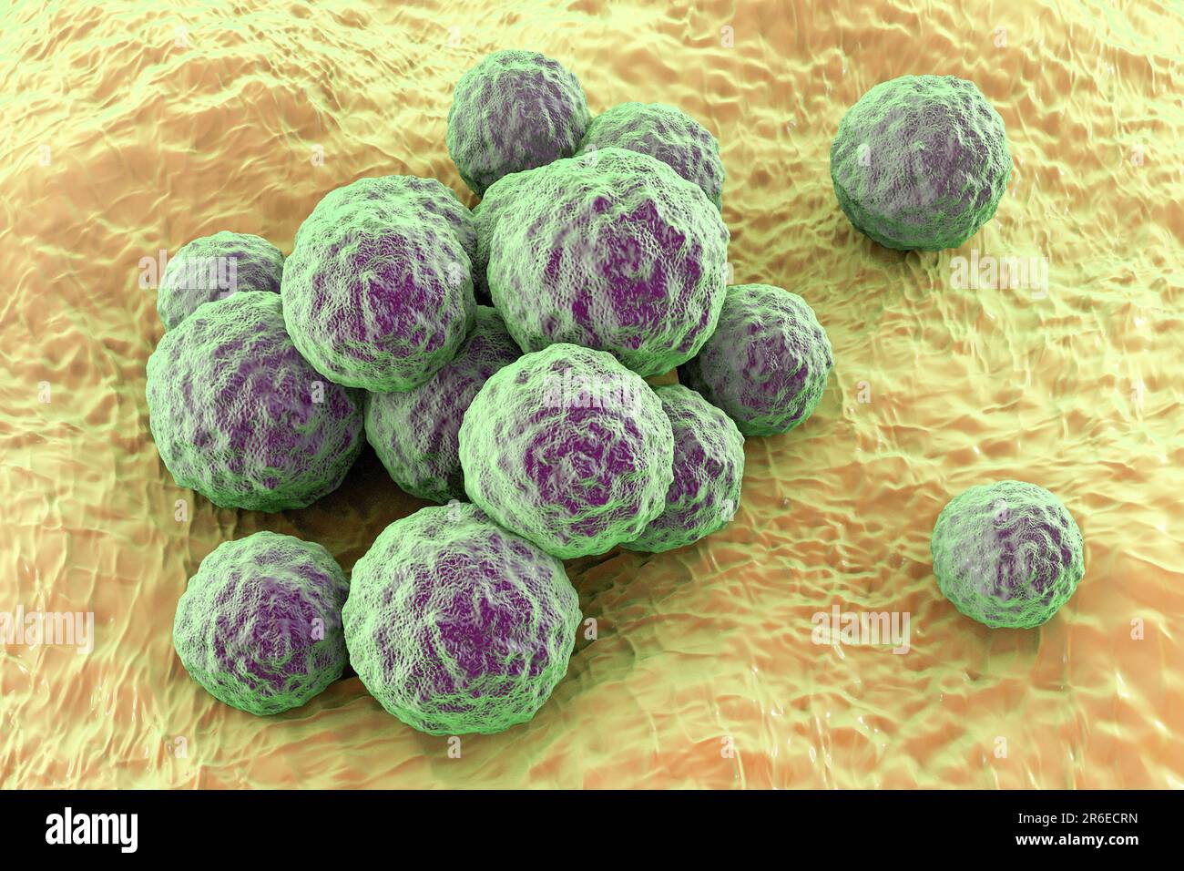 MRSA bacteria. Computer artwork of methicillin-resistant Staphylococcus aureus (MRSA) bacteria ...