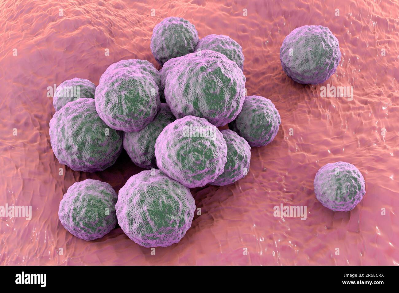 MRSA bacteria. Computer artwork of methicillin-resistant Staphylococcus ...