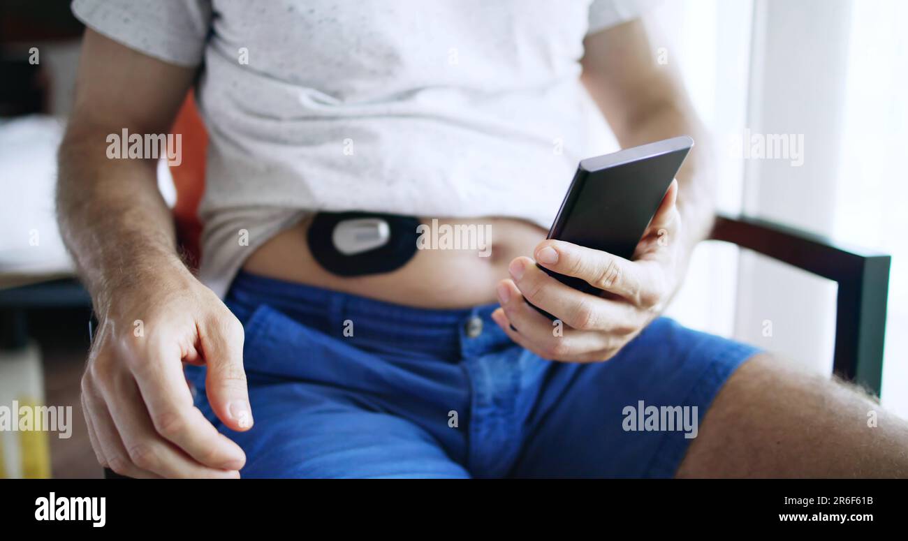 Man Using Continuous Glucose Remote Monitor Diabetes Sensor Stock Photo ...