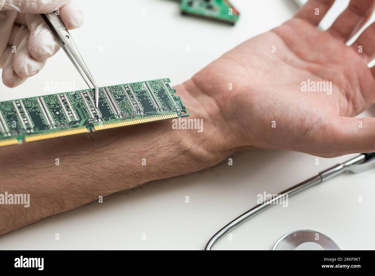 Hand with implantation of micro chip. X-Ray view close-up. Chipization ...
