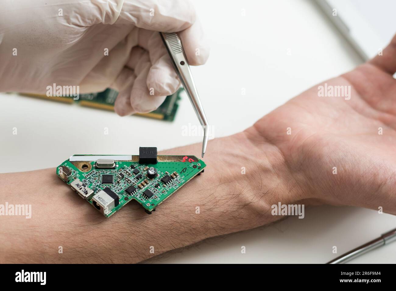 Hand with implantation of micro chip. X-Ray view close-up. Chipization ...