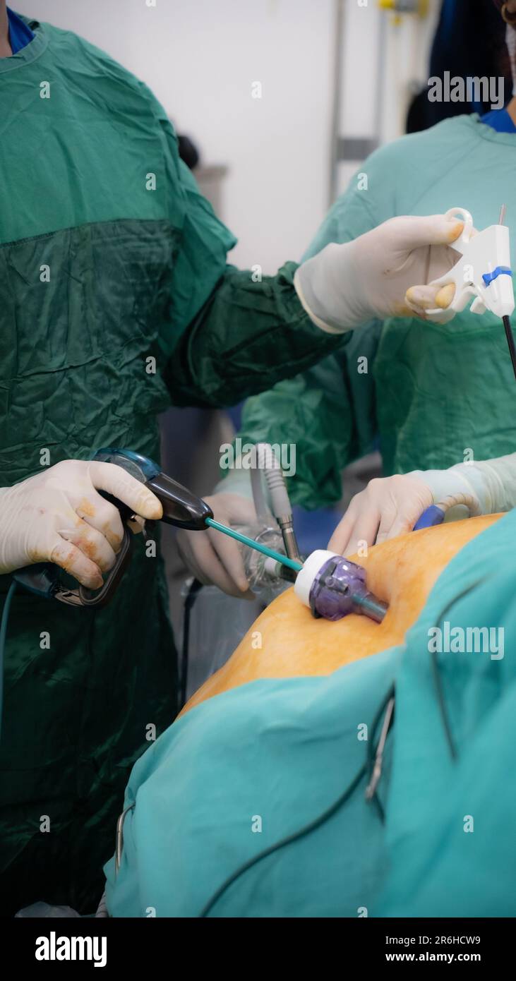 Obesity surgery. Woman preparing for obesity surgery. Before the ...