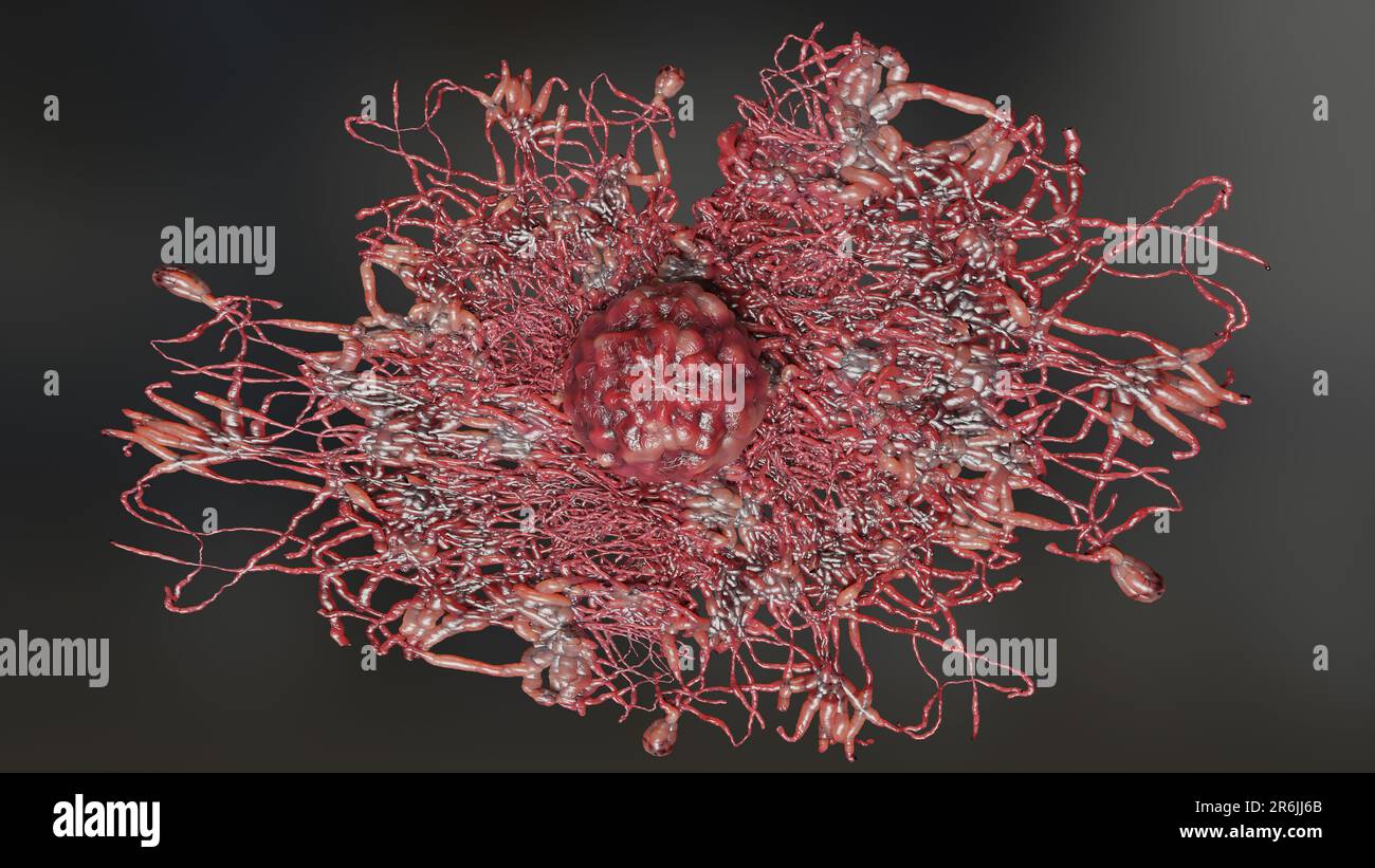 Cancer cell growth uncontrollably over tissue, Tumor infection cells ...