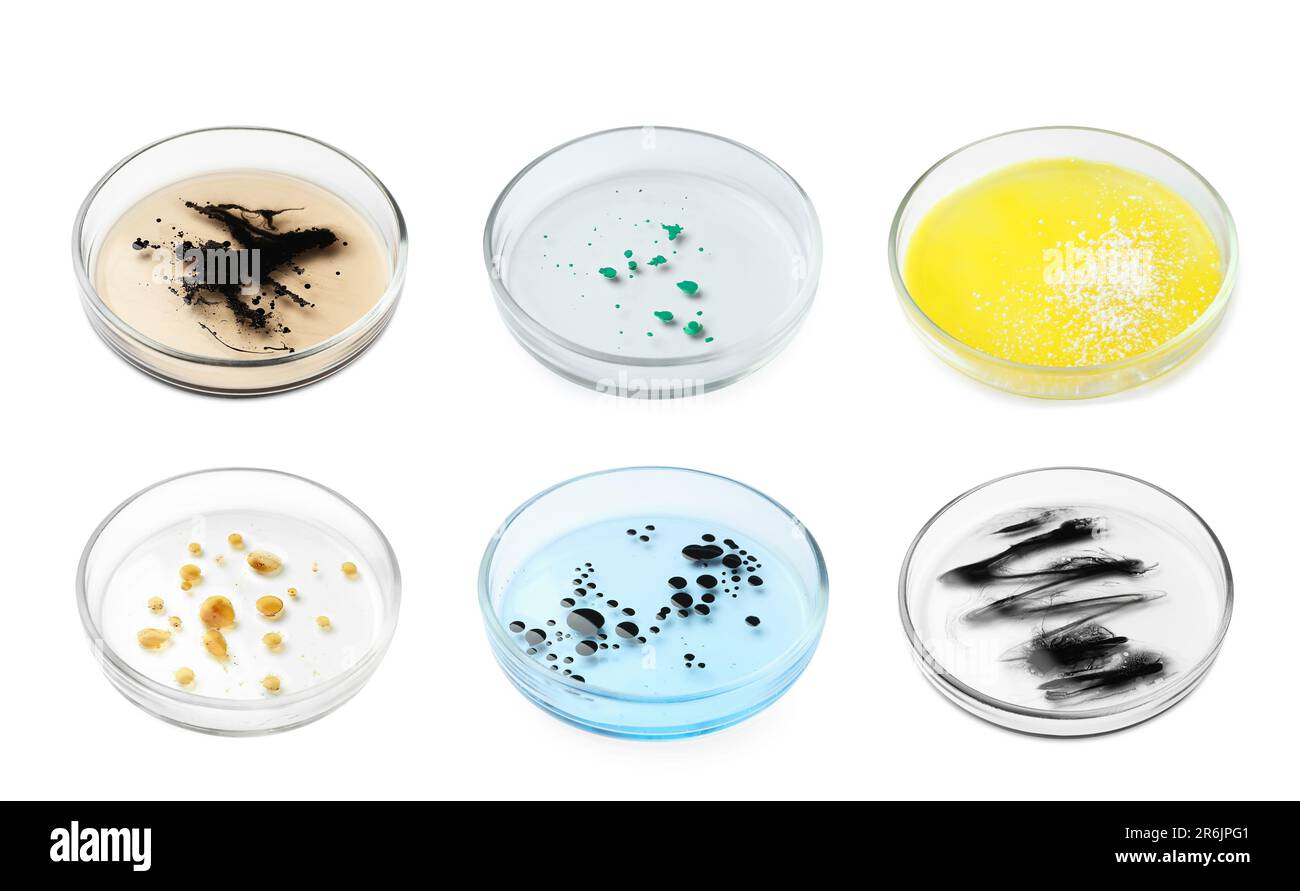 Discovering The Microbial World: Create Your Own Agar, 41% OFF Discovering The Microbial World: Create Your Own Agar, 41% OFF