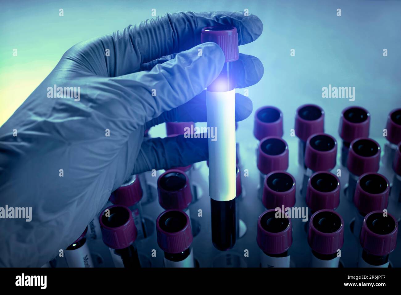 Laboratory worker putting test tube with blood sample into rack ...