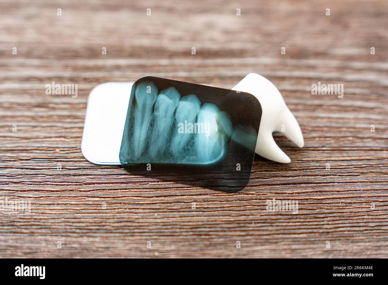 X-ray of a tooth and a large white tooth model placed on a wooden ...