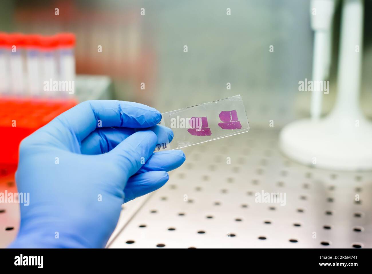 Close up photo of hand in blue glove handing histological liver tissue ...