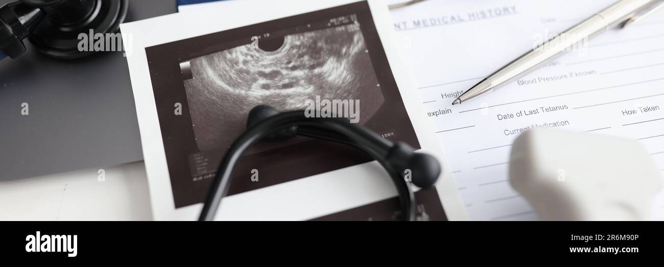 Modern ultrasound device with sensor and ultrasound of uterus Stock ...