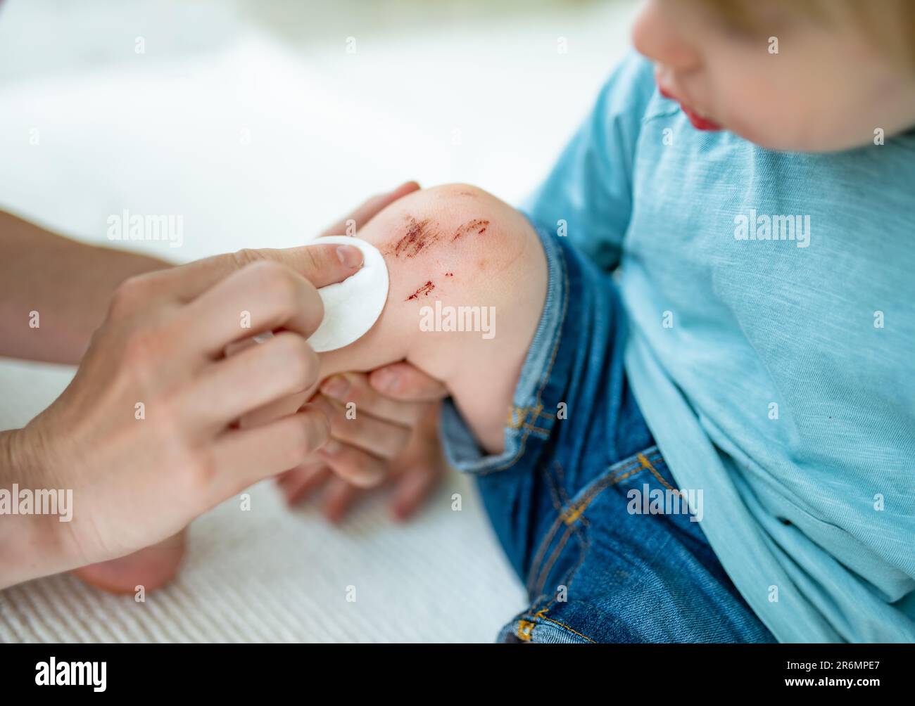Toddler boy with sore scraped knees. Parent helping her child perform ...