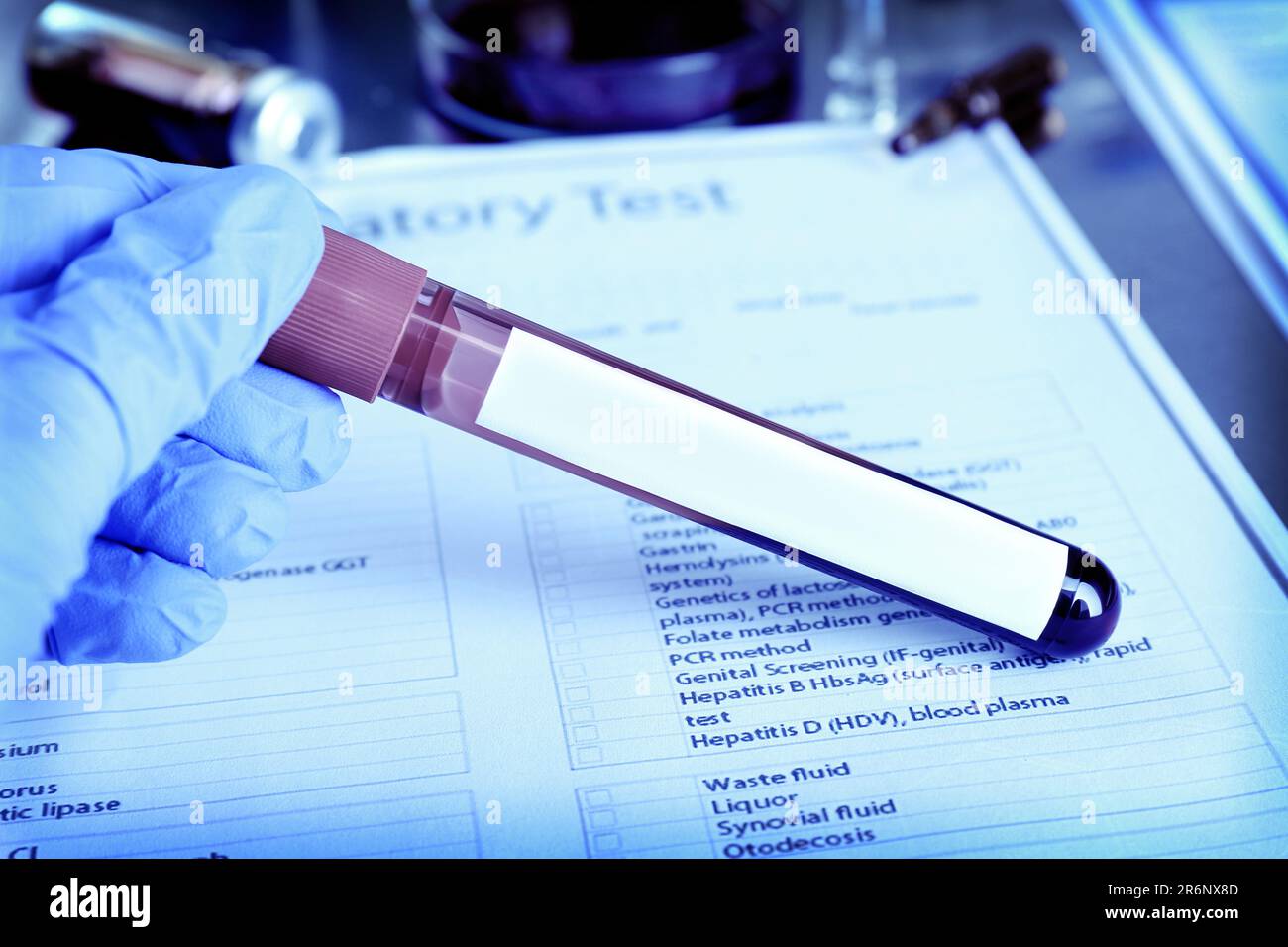 Laboratory worker holding test tube with blood sample over medical form ...
